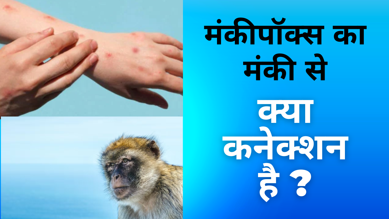 What Is Monkeypox Virus? What Is The Connection Between Monkeypox And ...